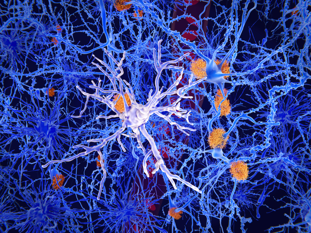Single-Cell Analysis of Inflammation - Chan Zuckerberg Initiative