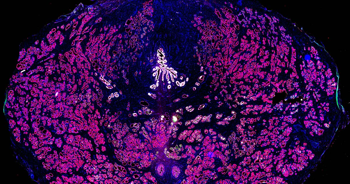 Ancestry Networks for the Human Cell Atlas Projects - CZI