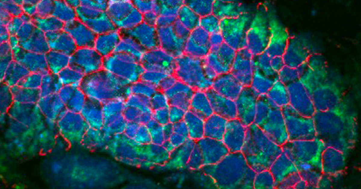 CZI Awards $5M to Advance Technologies and Bioimaging - CZI News