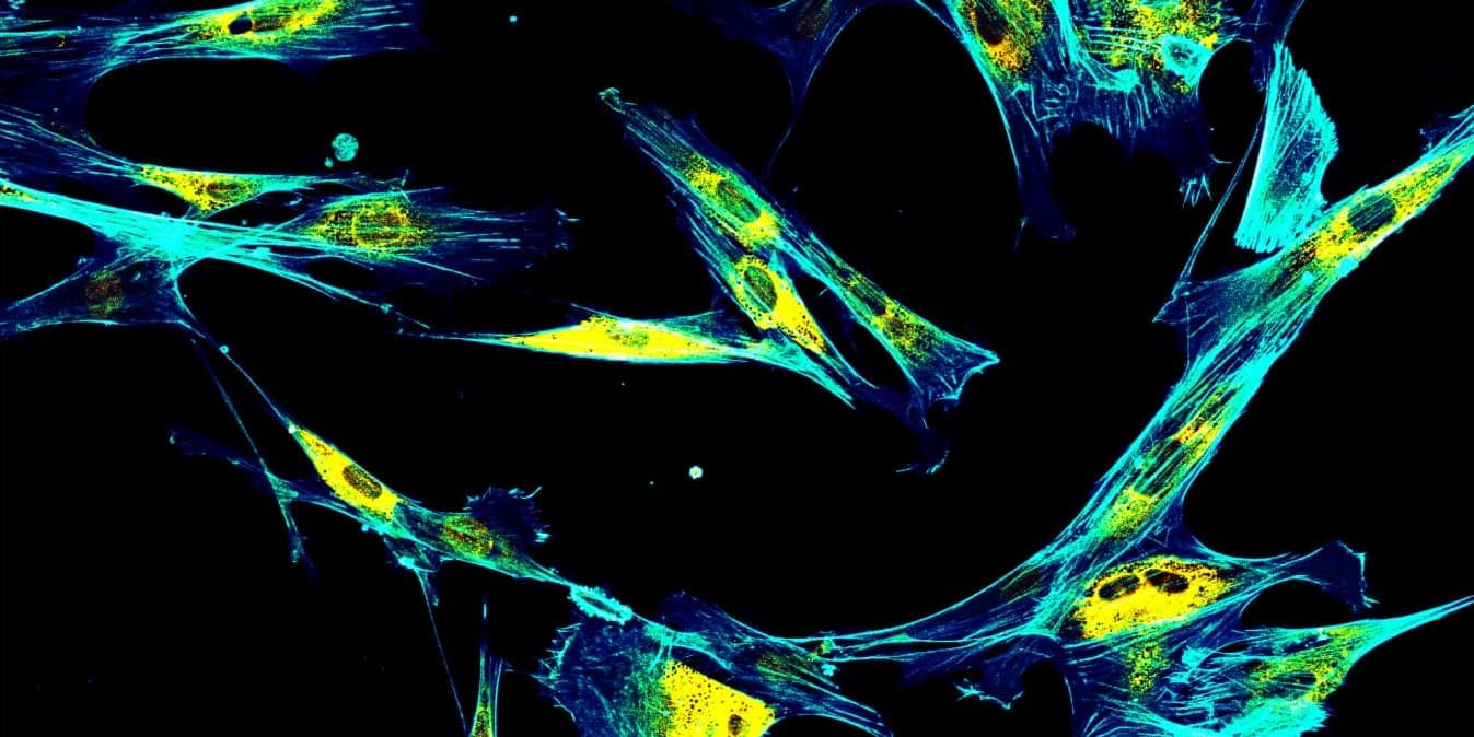 Patient-Partnered Single Cell-Analysis of Rare Inflammatory Pediatric ...